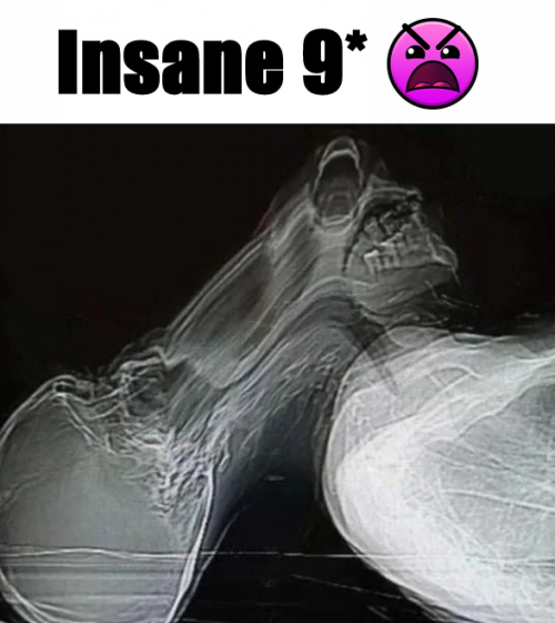 Emil levels Tier List (Community Rankings) - TierMaker