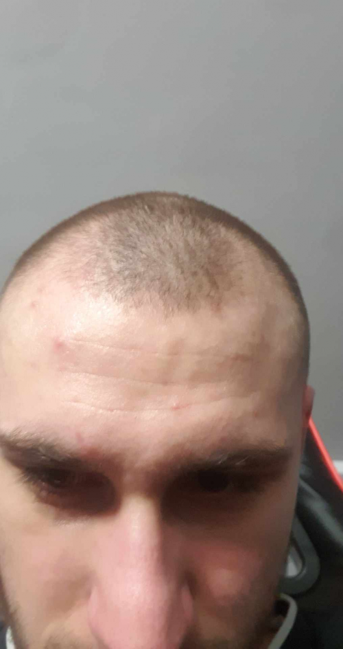 Dupki Dawka Tier List (Community Rankings) - TierMaker