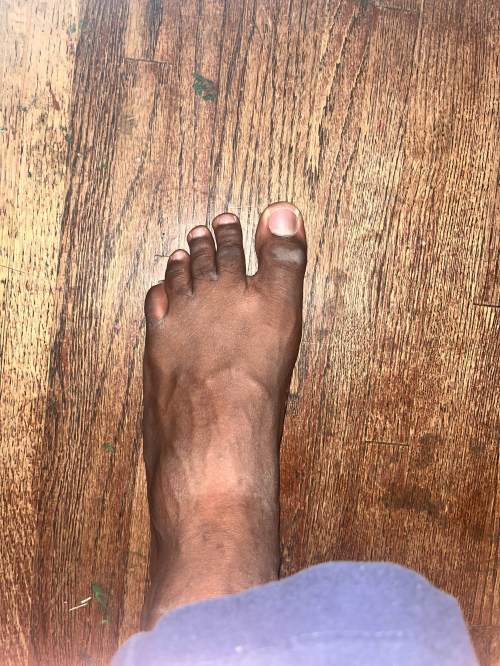 top 5 toes based off suckability Tier List (Community Rankings) - TierMaker