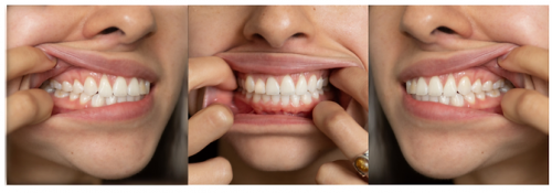 Create a Teeth Contest Tier List - TierMaker